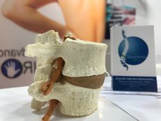 Subluxación: definición, efectos, síntomas y causas. - QuiroMurcia